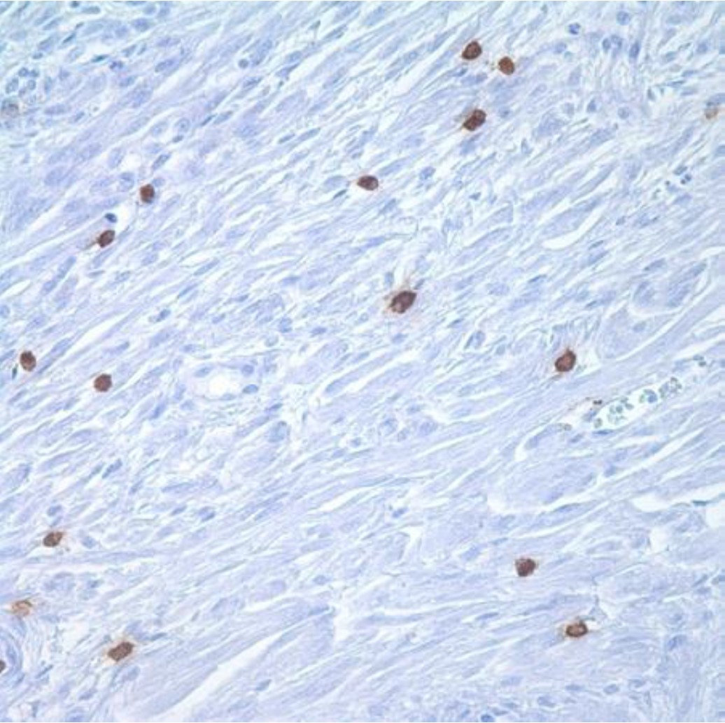 Tryptase, ILM3423-C01