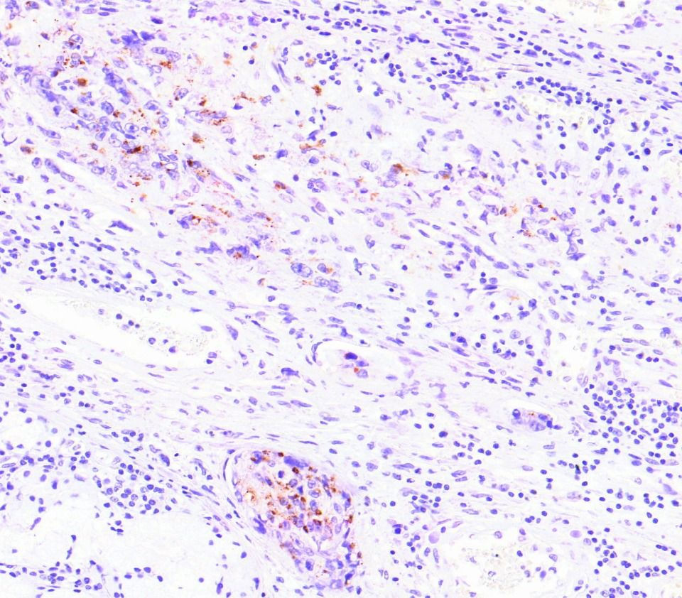 Napsin A Klón: KCG1.1 Katalógus # 10082