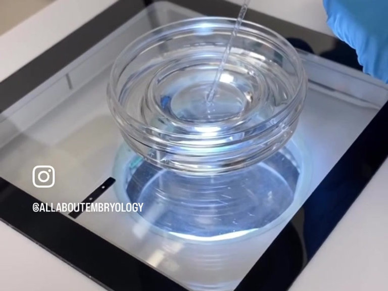 The embryo transfer procedure in the IVF laboratory