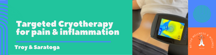 Targeted Cryotherapy in Troy & Saratoga