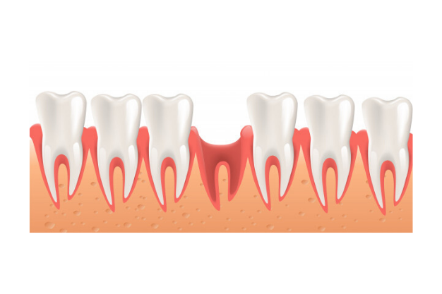 General & Cosmetic Dentistry - Tooth By Sunny Badyal