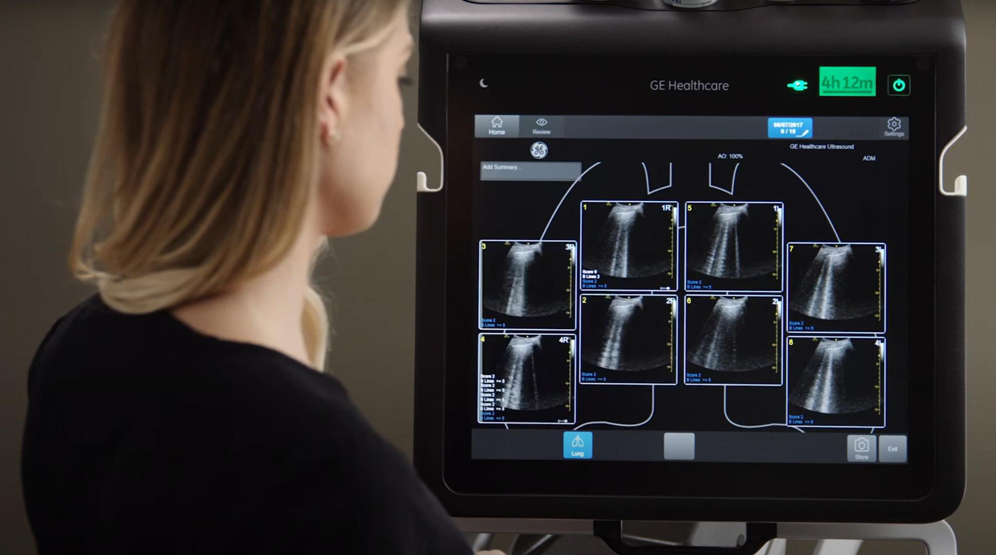 GE Ultrasound Feature Shock Toolkit | Offers tools for rapid, focused ...