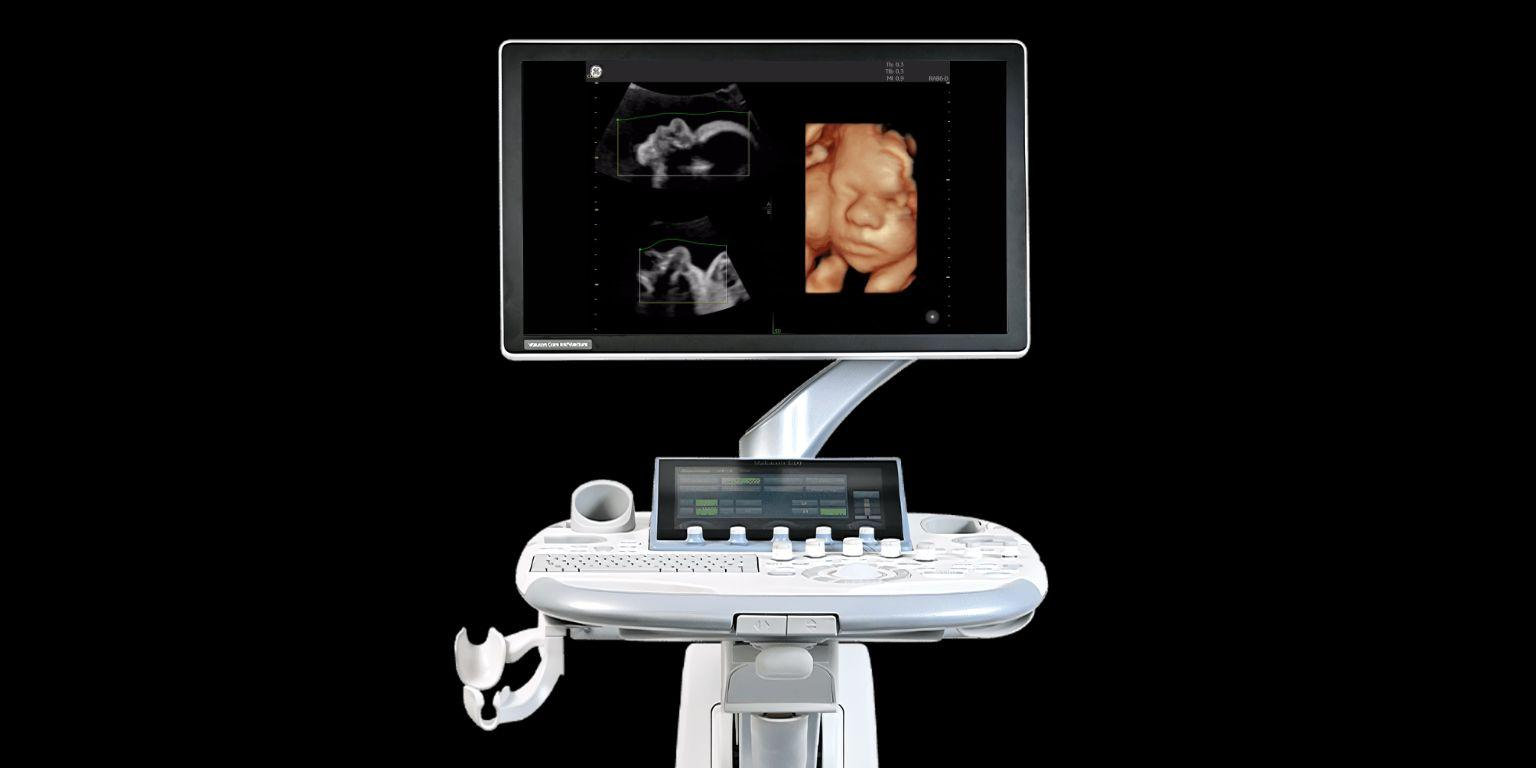 Download a New GE Voluson S10 Brochure