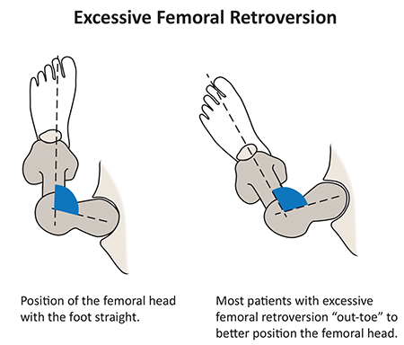 Improve Posture: Visual Analysis Guide for Fitness Trainers