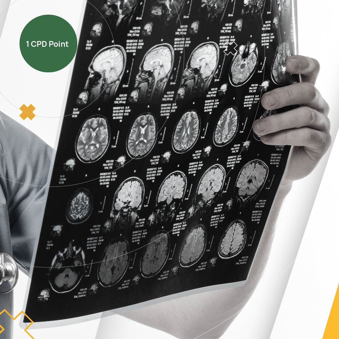 HIV Masterclass - Management of HIV-Associated Focal Brain Lesions ...