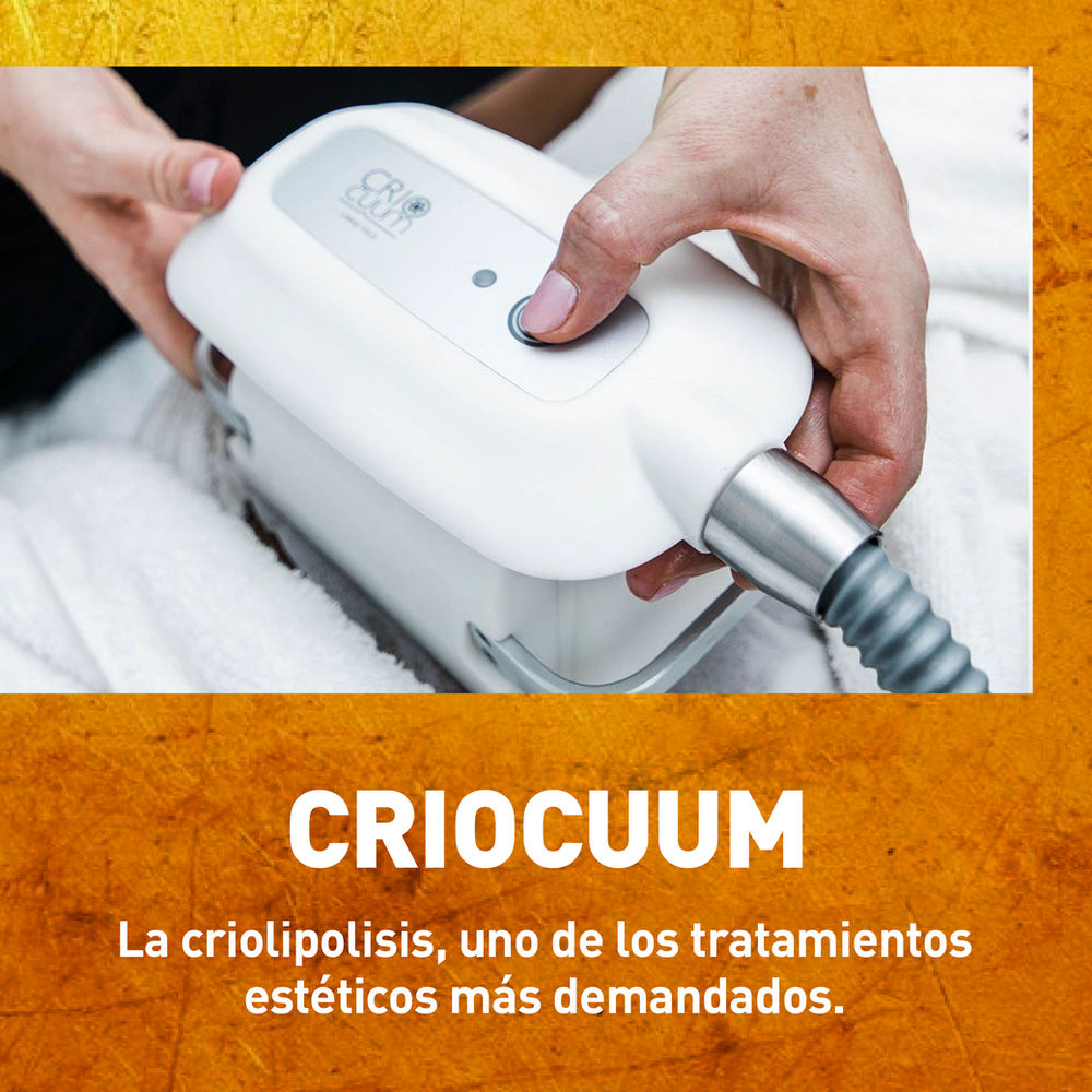 CRIOLIPOLISIS
