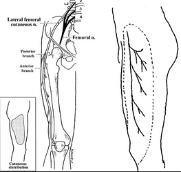 Meralgia Paresthetica | Pain Management