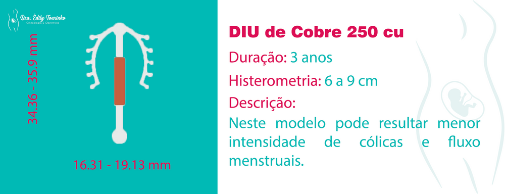 Tipos de DIU de Cobre
