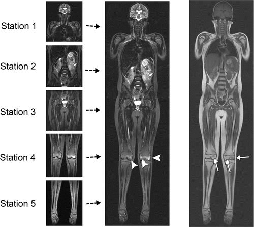Full Body MRI package info | SPACELITE WATER