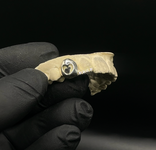 Cap with Diamond Tip Grillz | Ls Grills