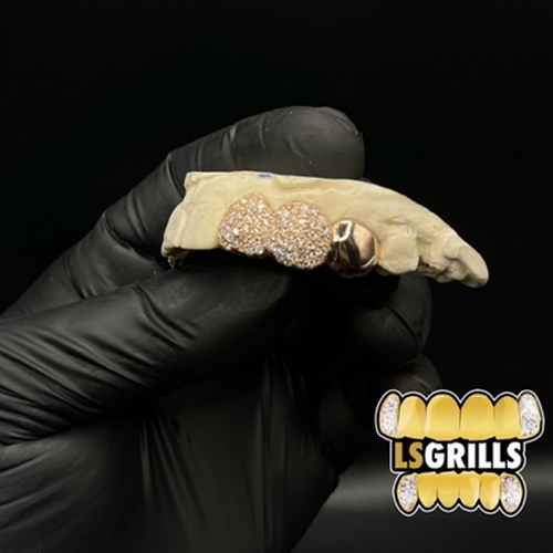VVS Diamond Cap Grillz | Ls Grills