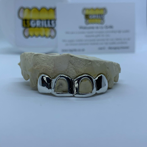 Windows Grillz | Ls Grills