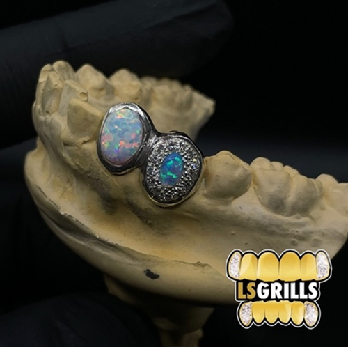 Opal with Diamonds Grillz | Ls Grills