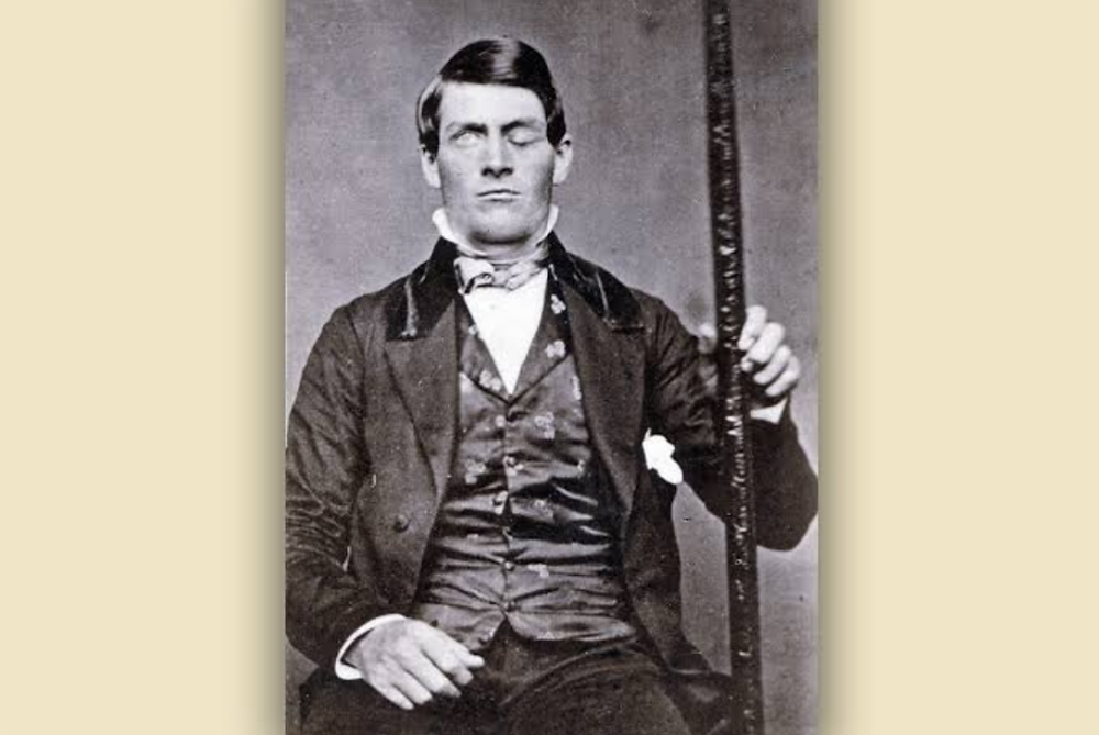Phineas Gage: The Incredible Case that Revolutionized Neuroscience
