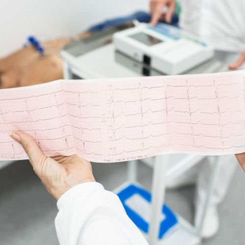 Electrocardiograma en Reposo (ECG) | Laboratorio ZAGA