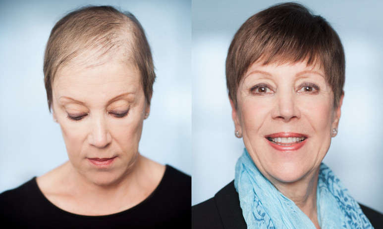 Evolve volumizer | Evolve Hair Solutions | United States