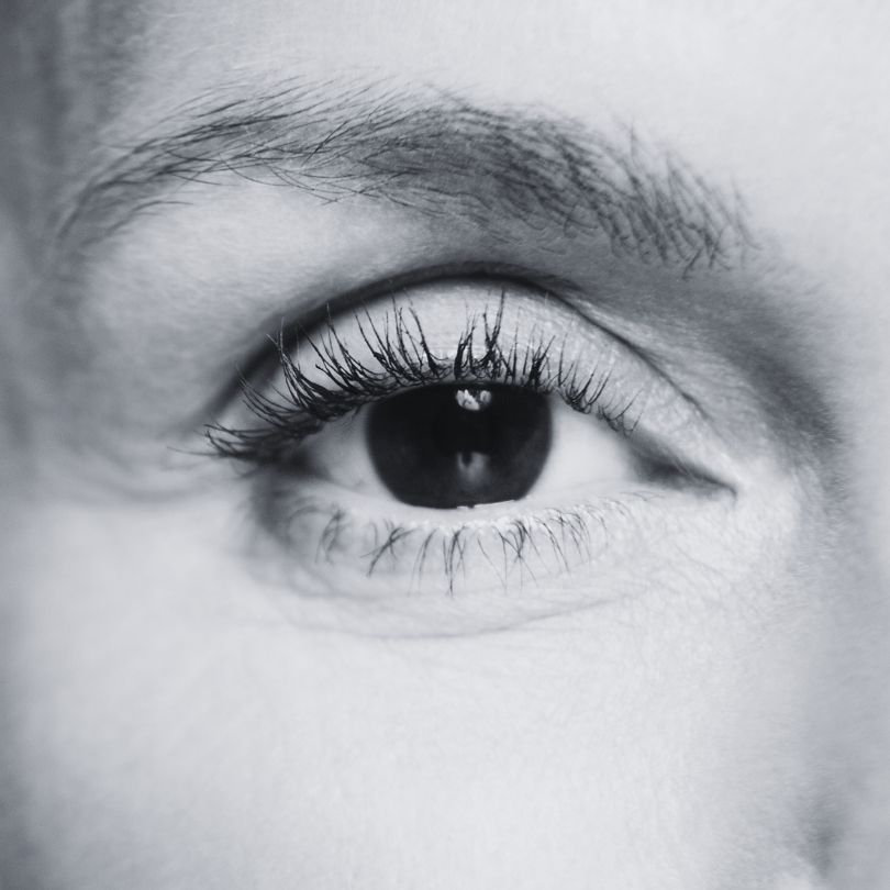 Robert Schwarcz MD | Treat Thyroid Eye Disease With TEPEZZA