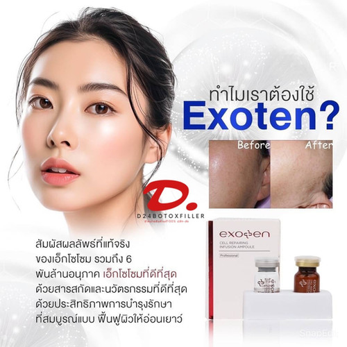 Exoten Exosome | D2whiteshop