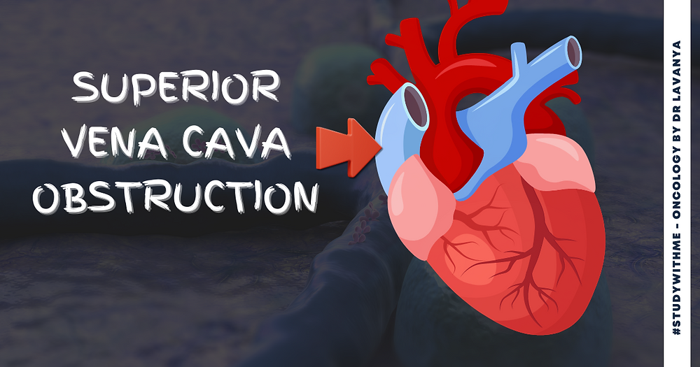 The Vascular Enigma: A Journey into SVC Obstruction