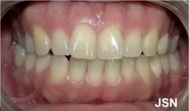 O Periodonto e a Gengiva