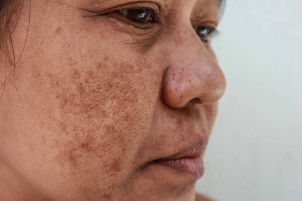 The Science of Pigmentation: Part 1 The Science of Pigmentation: Part 1