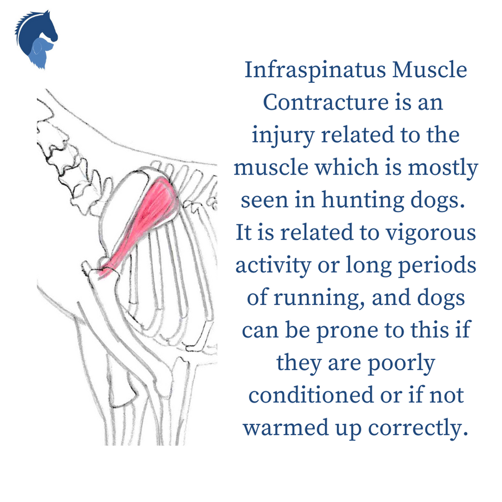 Muscle of the Month: Infraspinatus