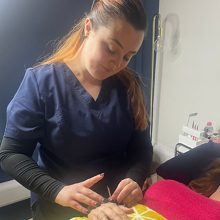 Acupuncturist in Sutton Coldfield | Laura the Acupuncturist