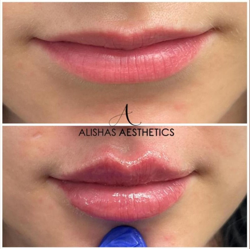 RUSSIAN LIP MASTERCLASS | Alisha' s Aesthetics