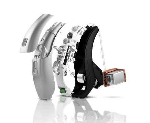 Hearing aid repair | HearingNow