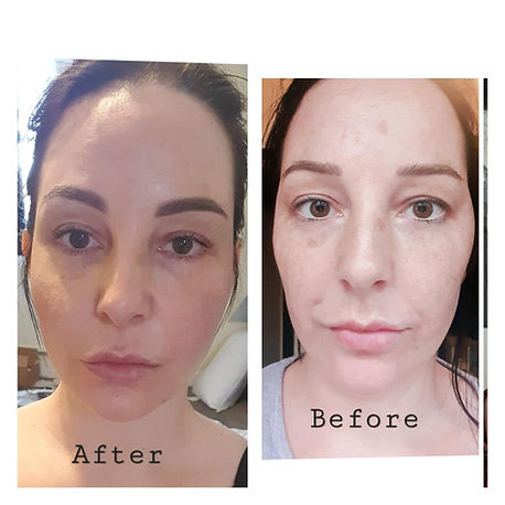BEFORE AND AFTERS | Ageing-Disgracefully