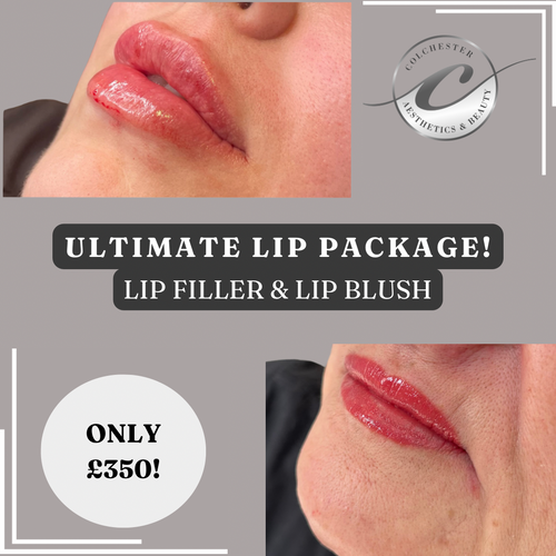 Ultimate Lip Package | Aesthetics & beauty