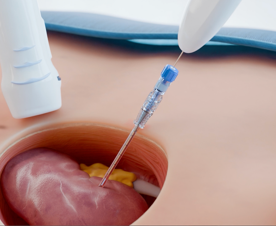 Contact Us | SinglePass