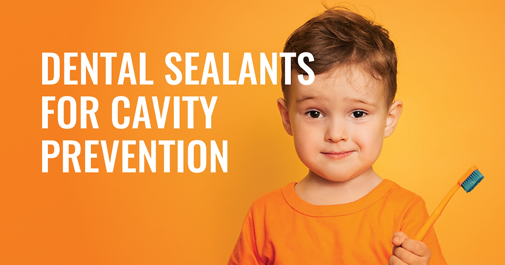 Dental Sealants for Cavity Prevention