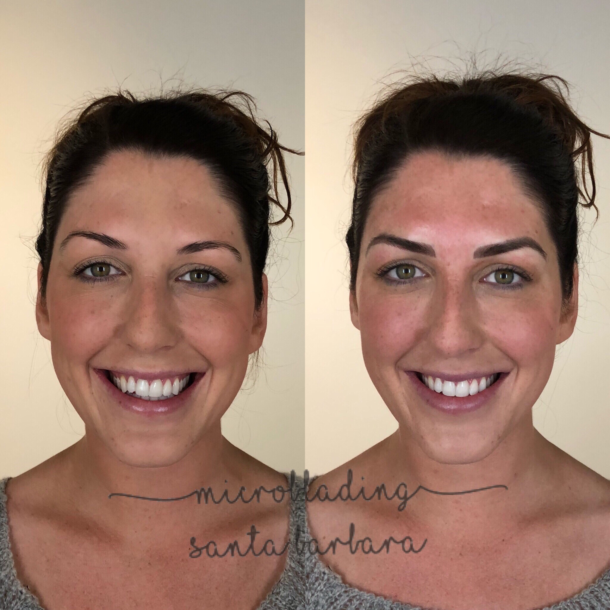 GALLERY | Microblading SB
