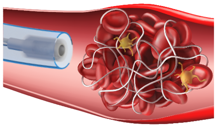 Milli-Spinner | Smcatalyst