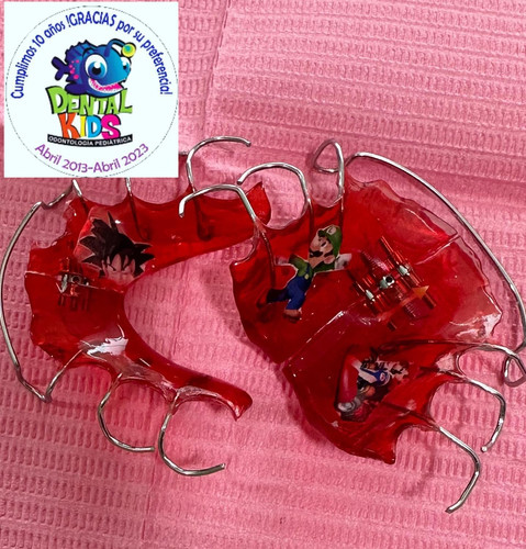 Expansores Personalizados | Dental Kids