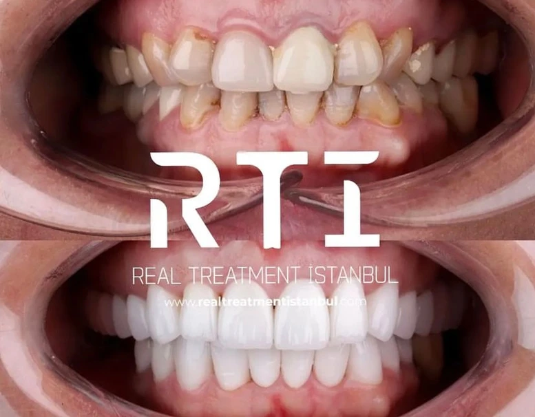 DENTAL TREATMENT | Real Treatment