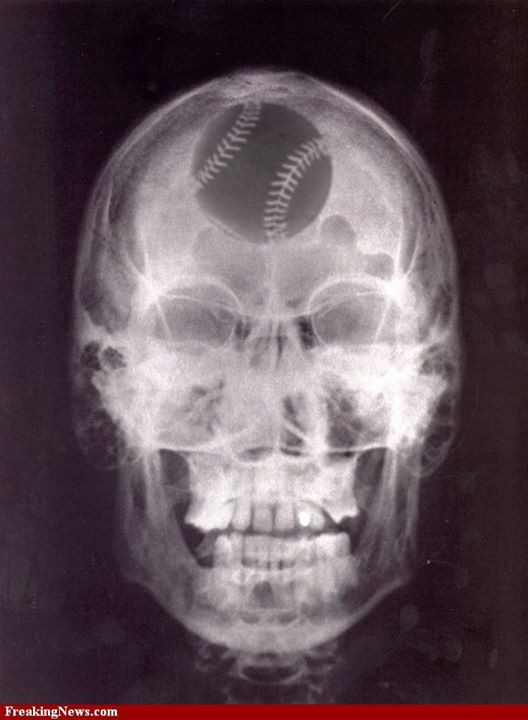 Chuck Brodsky | Baseball