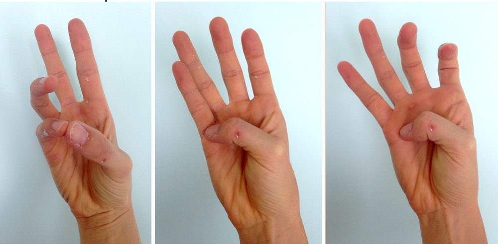 Thumb Rehab and Injury Prevention
