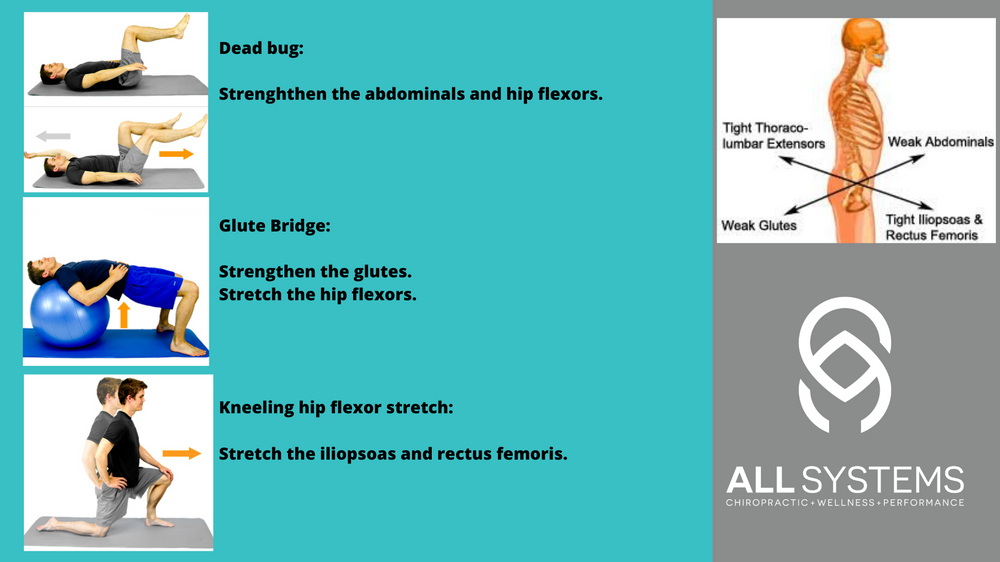 Upper and Lower Crossed Syndromes