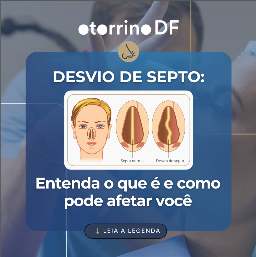 Desvio de Septo : Entenda o que é e como pode te afetar