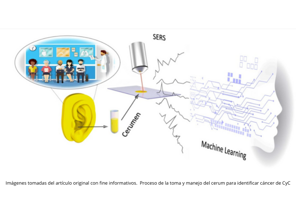 El análisis de cerumen con SERS y machine learning detecta cáncer de ...