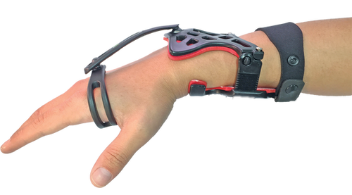 Zero-Cast Wx (For wrist fracture) | Zero-Cast