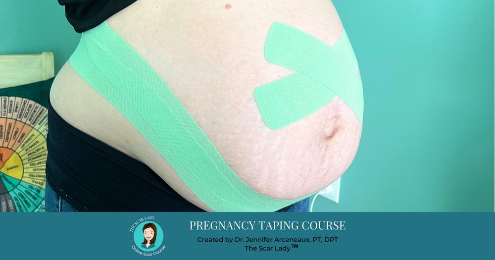 Scar Resources | The Scar Lady