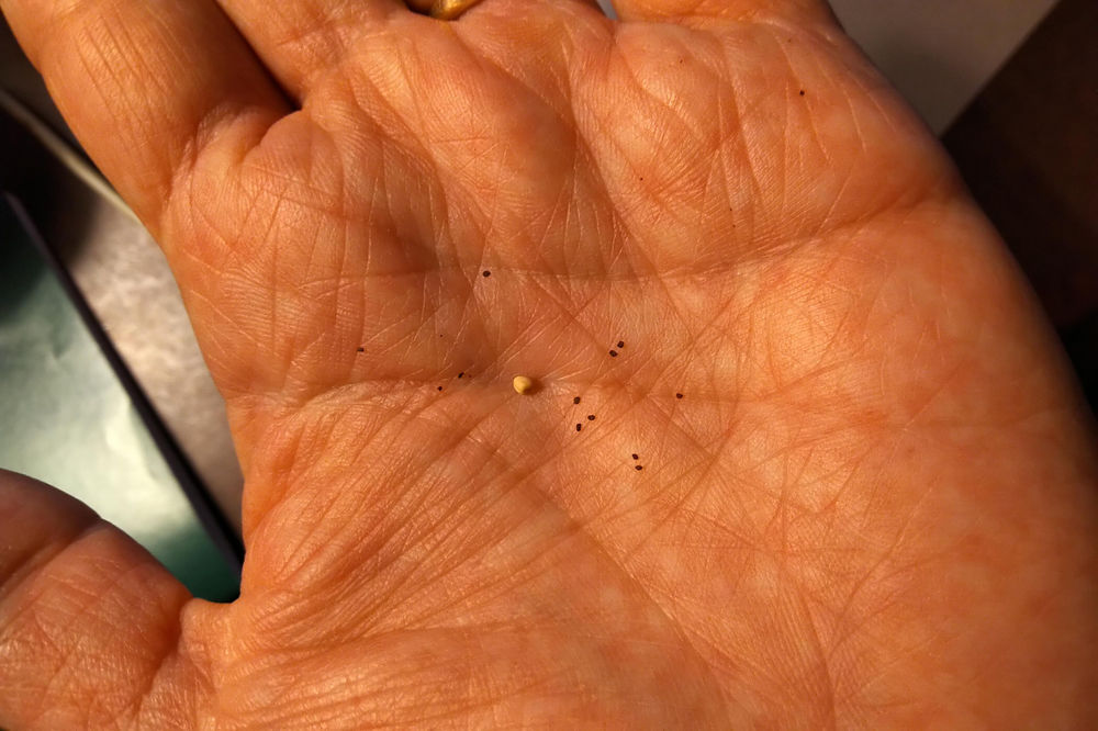 Faith The Size Of A Mustard Seed Faith The Size Of A Mustard Seed