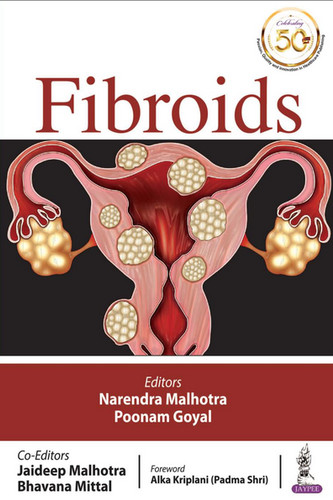 Fibroids | Drive de Estudos