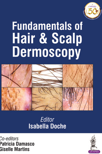 Fundamentals of Hair & Scalp Dermoscopy | Drive de Estudos