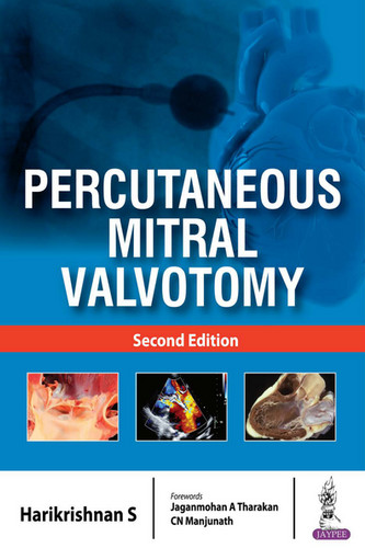 Percutaneous Mitral Valvotomy | Drive de Estudos
