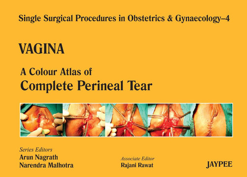 A Colour Atlas of Complete Perineal Tear | Drive de Estudos