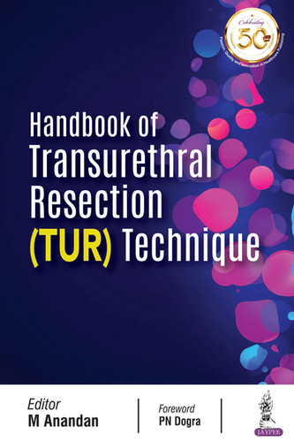 Handbook of Transurethral Resection (TUR) Technique | Drive de Estudos